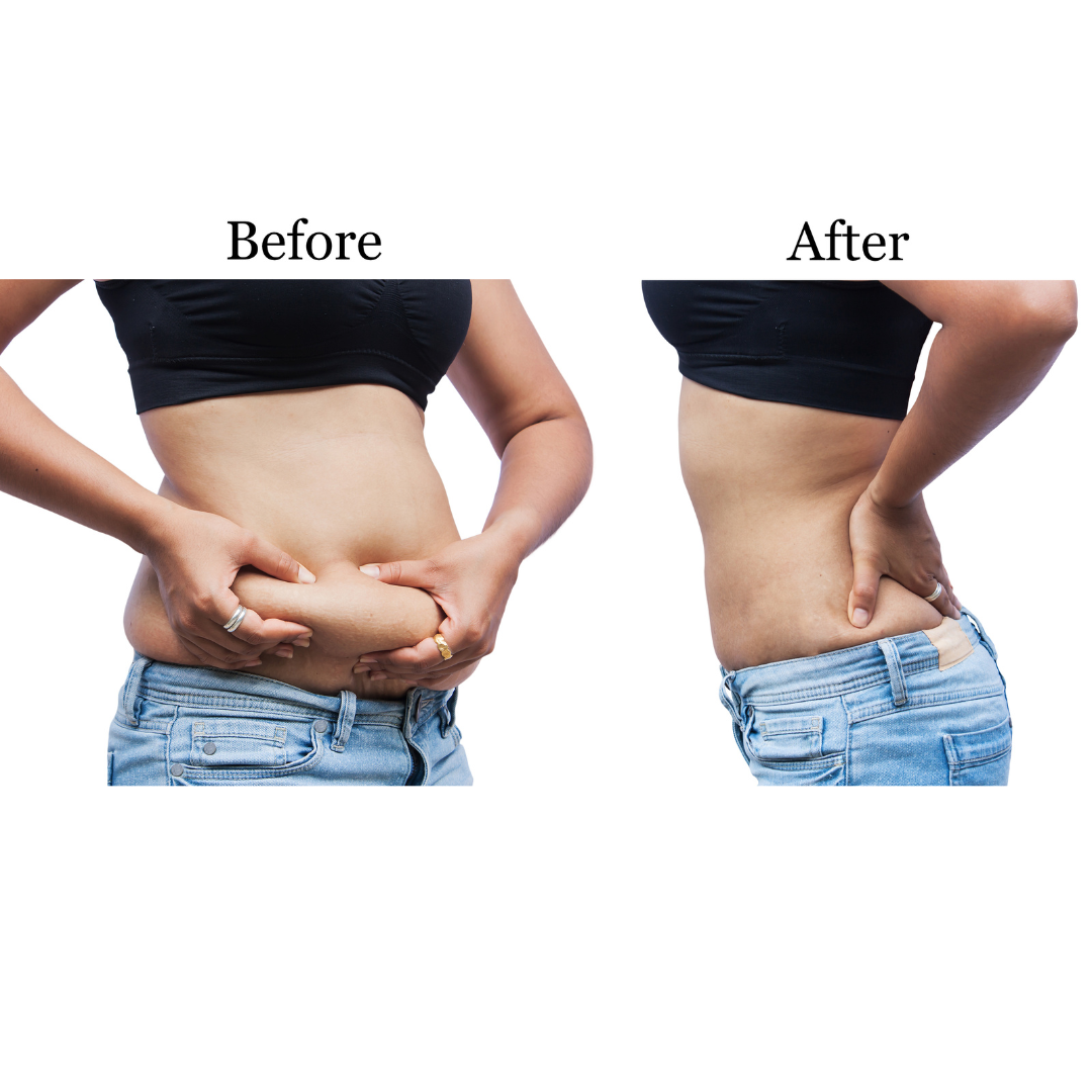 Fat Dissolving – Obsessed Training Academy